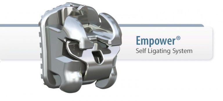 Braces / Empower® - Caruso Orthodontics